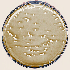 Serial Dilutions and Yeast Plate Count