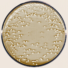 Serial Dilutions and Yeast Plate Count